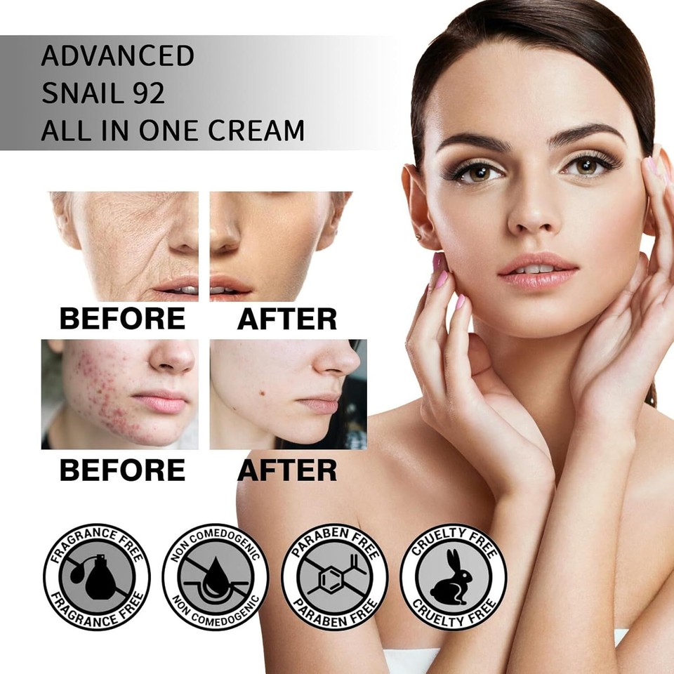 Snail Mucin Cream, 92% Pure Snail Slime Extract Moisturizer for Face ...