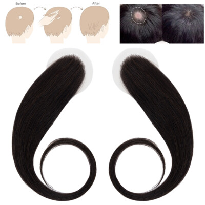 Front Hairline Hair Patch, Bald Spot Hair Piece Real Human Hair Topper ...