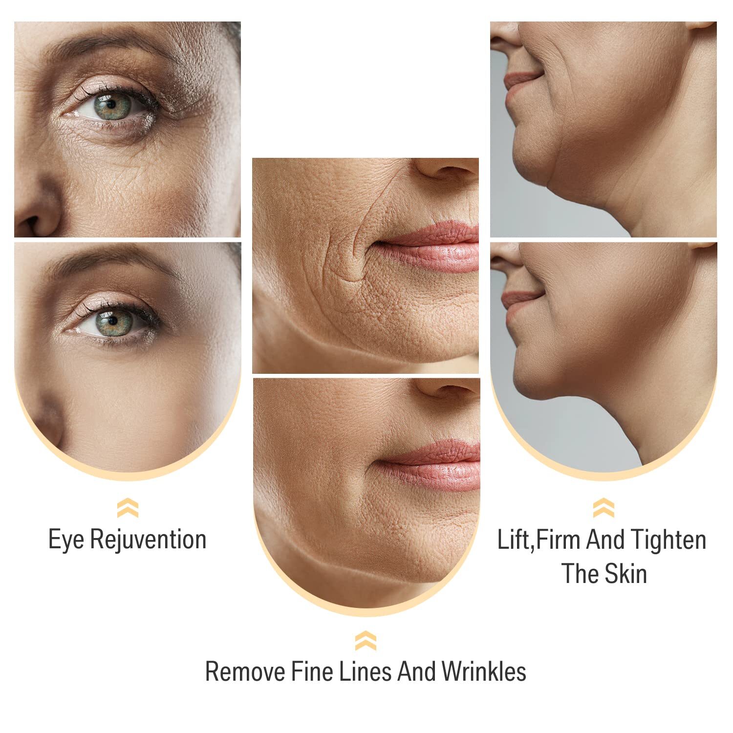 MLAY RF01 Radio Frequency Skin Lifting Device for sale online | eBay