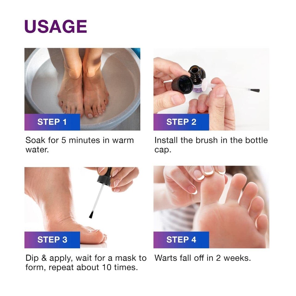 Foot Corn Remover: Liquid for Toes and Feet; Effective Corn and Callus ...
