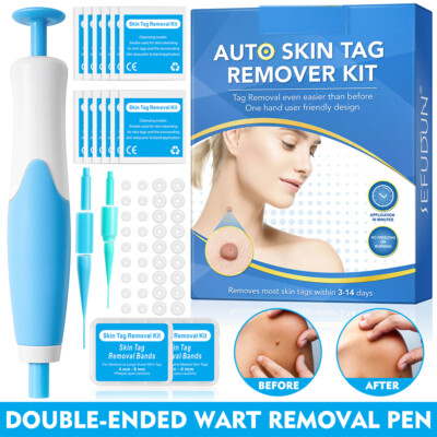 2-in-1 Micro Auto Skin Tag Remover Pen Tool Kit Painless Wart Skin Tag ...