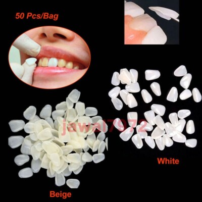 Resin Thin Dental Teeth Tooth Upper Anterior Front Protection Temporary ...