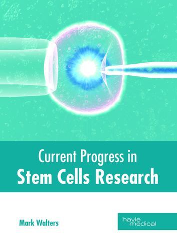 Current Progress in Stem Cells Research [Hardcover] 9781632414892 | eBay