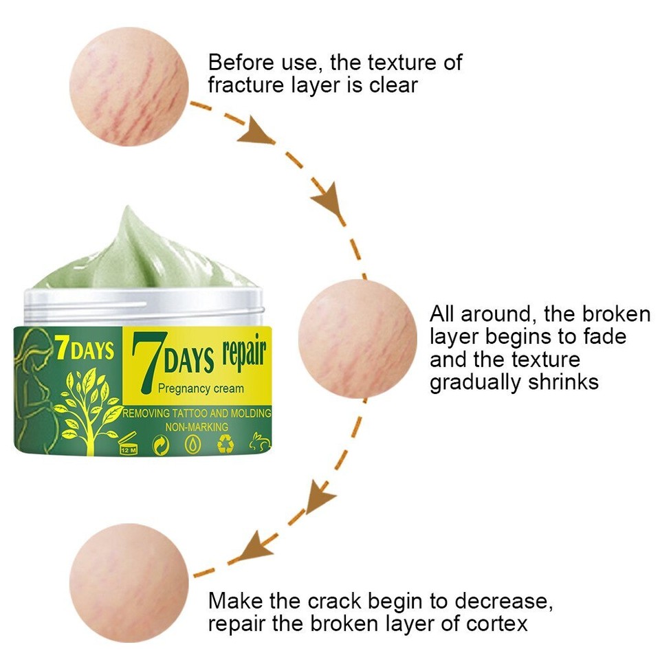 Pregnancy Scar Repair Cream Stretch Marks Removal Fat Stretch Mark ...