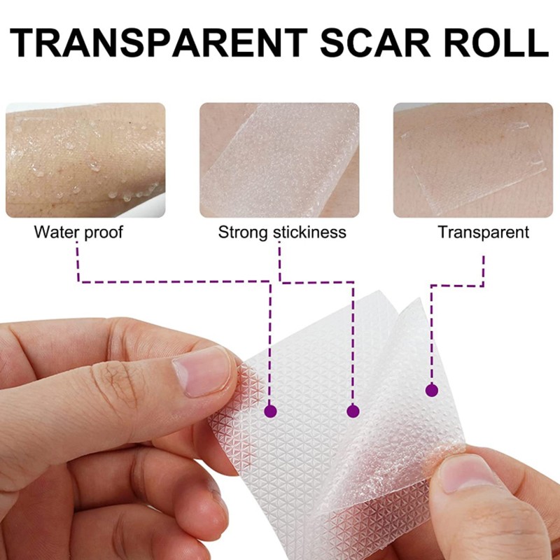 Scar Patches Remove Silicone 1mm Gel Treatment Patch Surgery Scar Tape ...