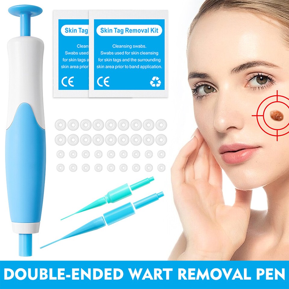 2 in 1 Natural Painless Auto Skin Tag Removal kit Skin tag bands ...