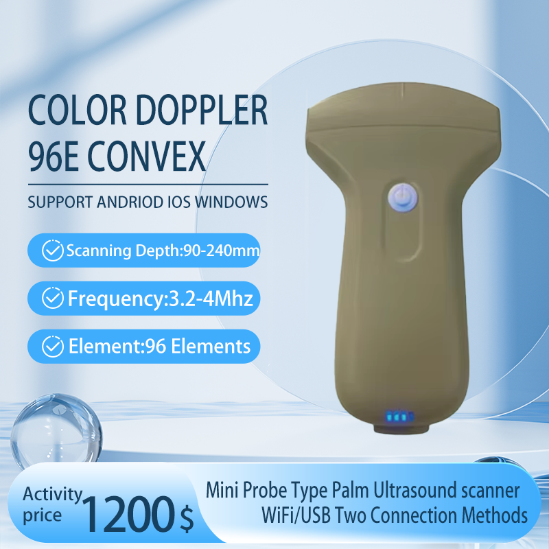 Portable Wireless Ultrasound Wifi/USB Connection 96E Color Linear ...
