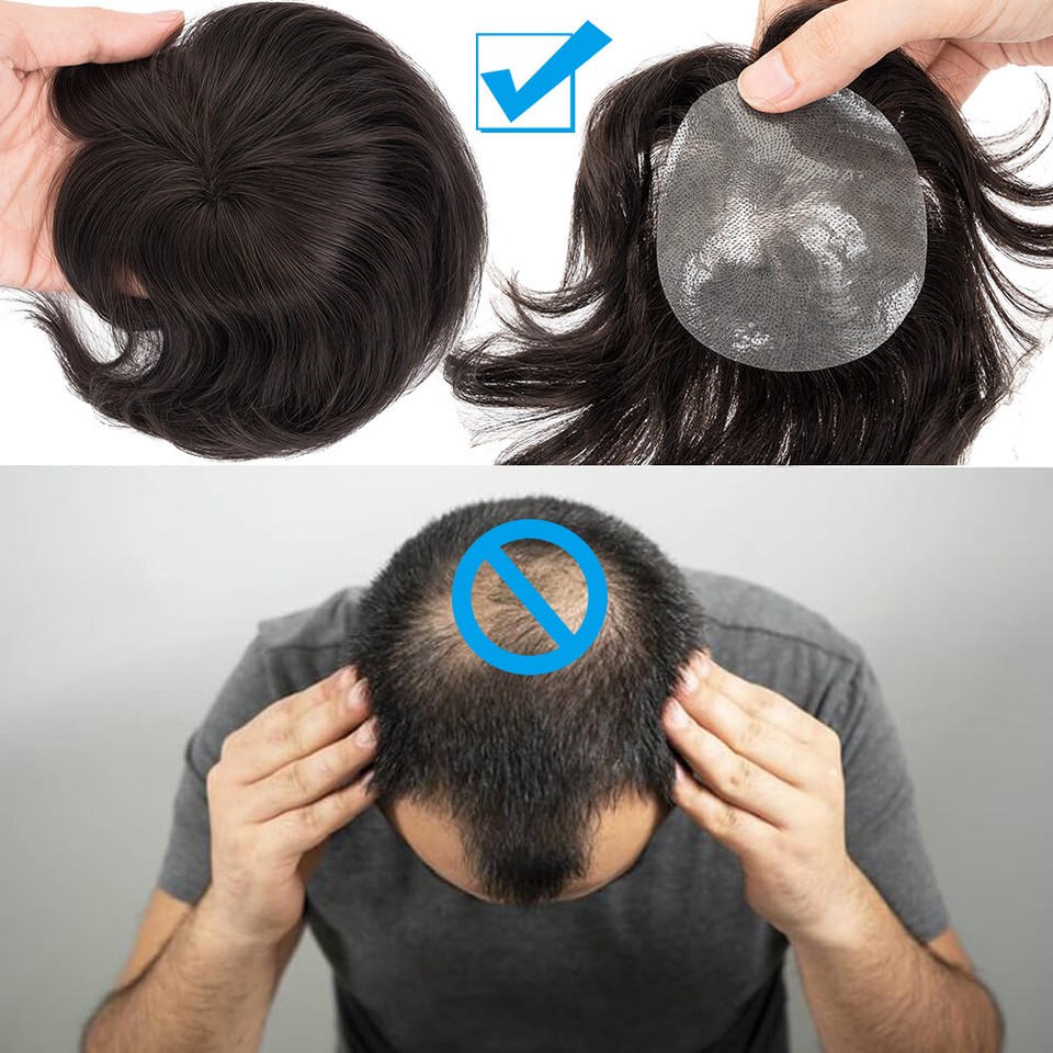 Men's Remy Human Hair Patches Pieces Toupee for Top Head Hair Loss Thin ...