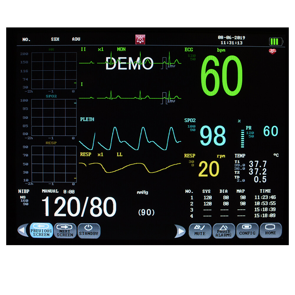 Cardiac Monitor Screen