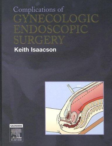 Complications of Gynecologic Endoscopic Surgery by Keith Isaacson (2006 ...
