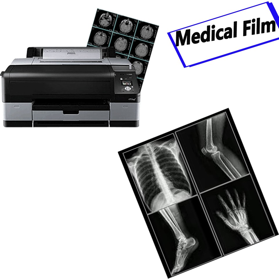 Waterproof Inkjet Instant-Dry Screen Printing Transparency Film 100 ...