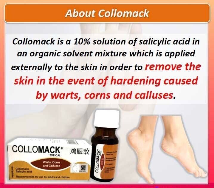 1 X COLLOMACK TOPICAL 10ml Painless Remover Plantar Warts Corns And ...