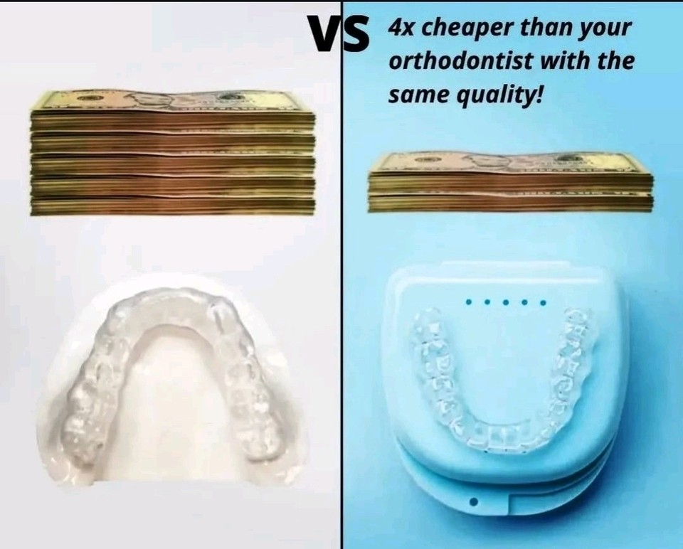Retainer With Teeth, Affordable Way To Fill In Your Smile, with 1-3 ...