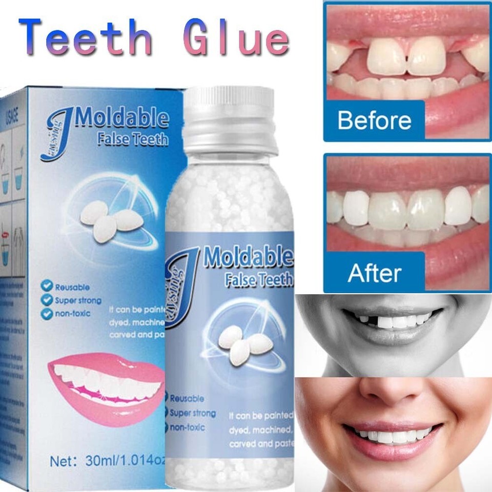 Permanent Strong Teeth Tooth Repair Dental Cement Cavity Filling Kit ...