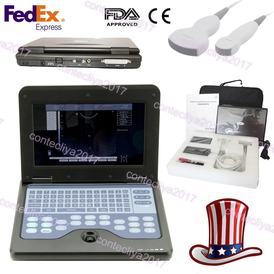Laptop Ultrasound Scanner Machine Convex/Linear/Cardiac/Tranvaginal ...