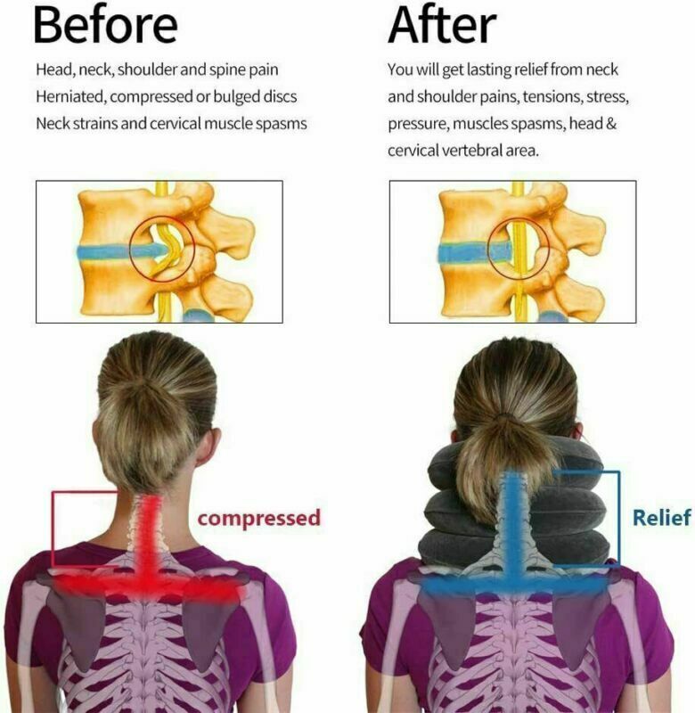 Air Inflatable Neck Pillow Cervical Head Traction Pain Relief Therapy ...