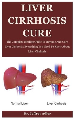 Liver Cirrhosis Cure: The Complete Healing Guide To Reverse And Cure ...