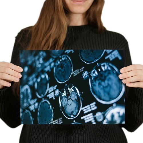 A4 - MRI Brain Scan X-Ray Images Poster 29.7X21cm280gsm #21825 | eBay