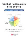 Cardiac Pacemakers Step-by-Step: An Illustrated Guide - Paperback ...
