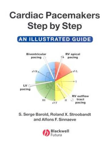 Cardiac Pacemakers Step-by-Step: An Illustrated Guide - Paperback ...