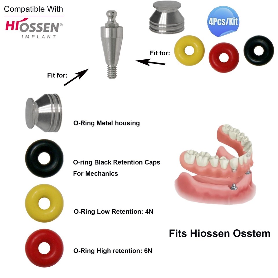 4Pcs/Set Dental Implant O-ring Retainer Caps Kit Ball Abutment ...