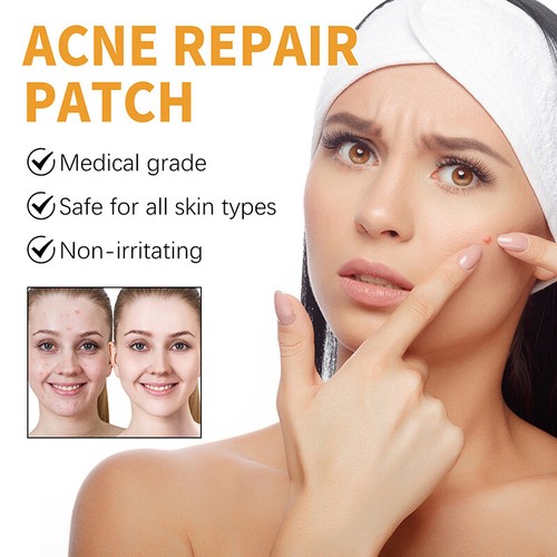 10Pcs Hydrocolloid Patches FaceMask Acne Pimple Zit For Nose Chin ...
