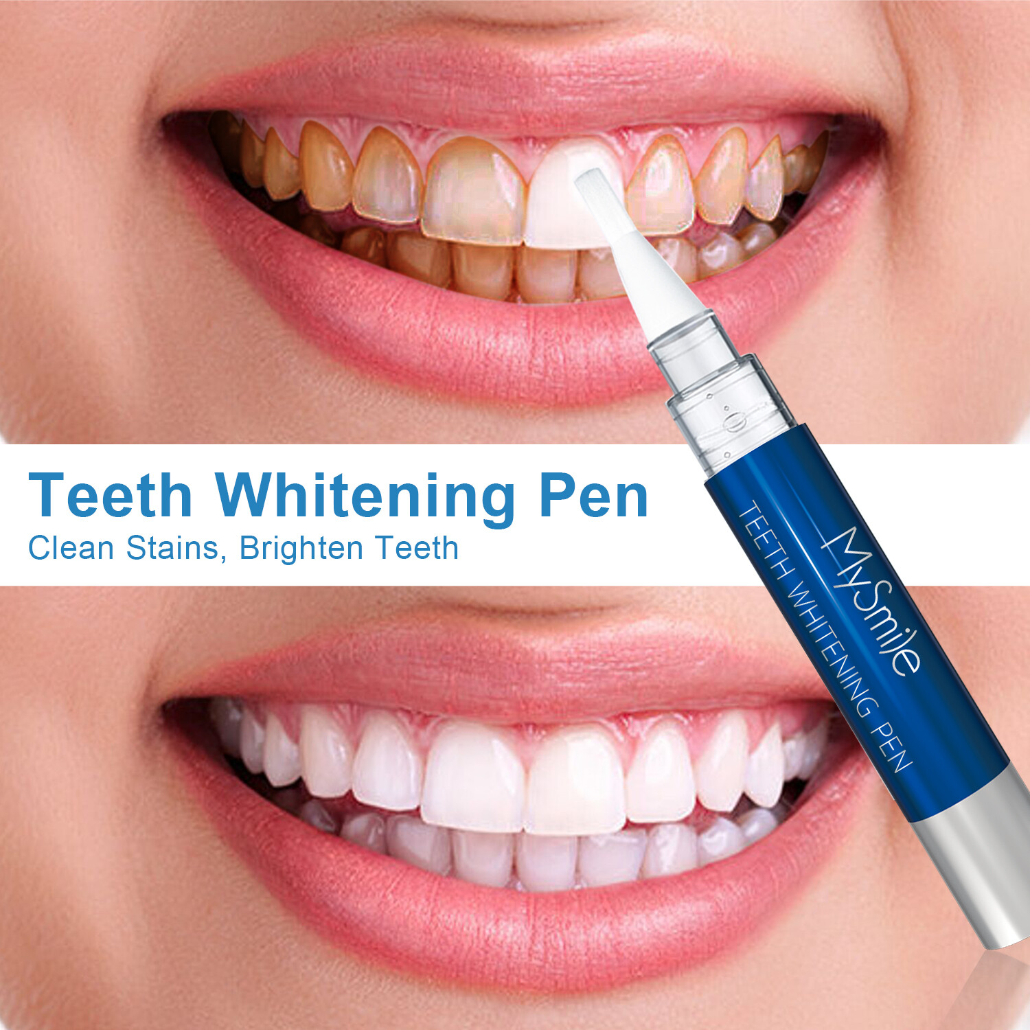 MySmile 2pc 4ml Teeth Whitening Pens Non-Sensitive Tooth Bleaching ...