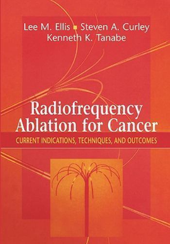 Radiofrequency Ablation for Cancer : Current Indications, Techniques ...