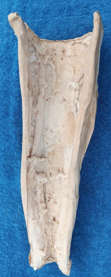 Vtg Plaster Human 1964 Mans Broken Leg Cast Orthopedics Hospital No ...