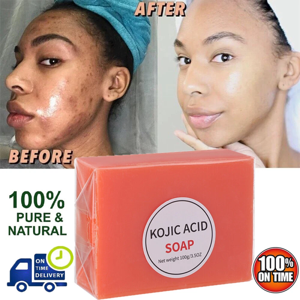 Kojic Acid Soap Before After