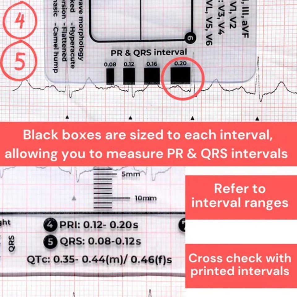 ECG 7 Step Ruler, ECG Ruler Plastic Ruler Measuring Tool Measuring ...