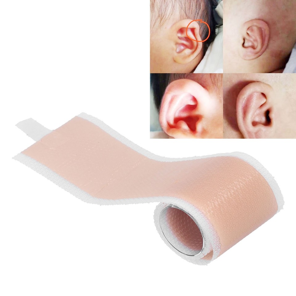Infant & Kids Silicone Ear Correction Stickers 4 x 50cm for Protruding ...