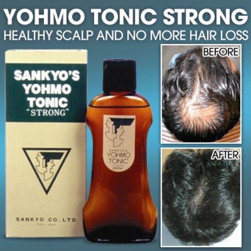 YOHMO TONIC Hair Tonic to prevent HAIR LOSS 200ml NEW ORIGINAL | eBay