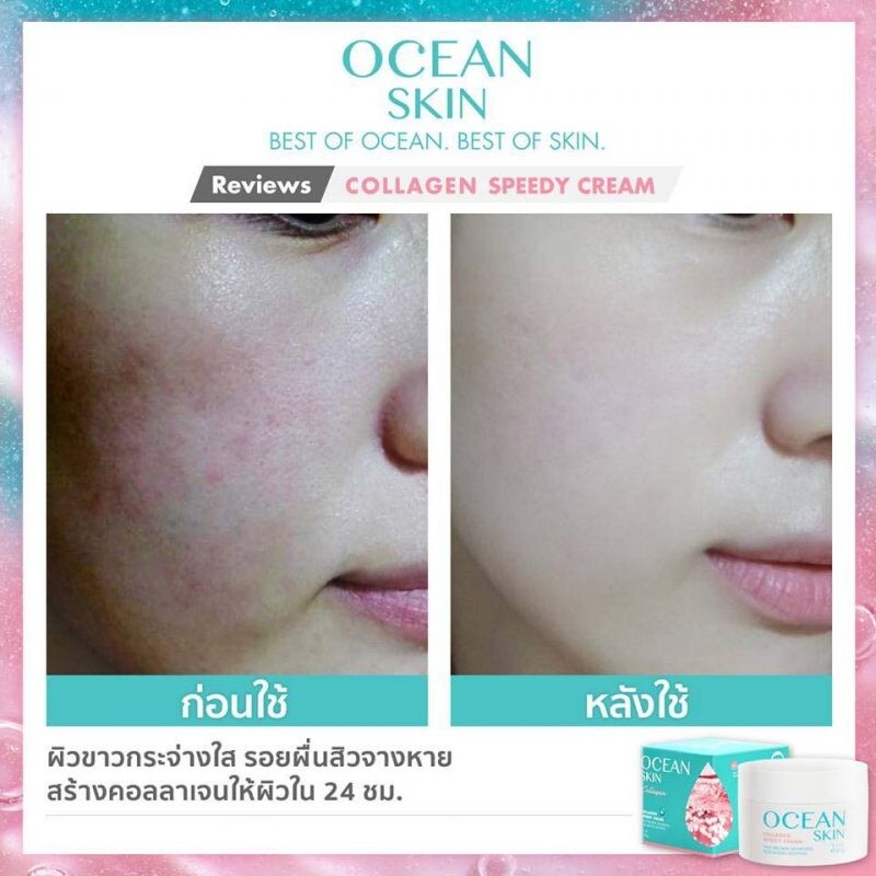 OCEAN SKIN Collagen Speedy Cream skin looks younger lustrous hydrated ...