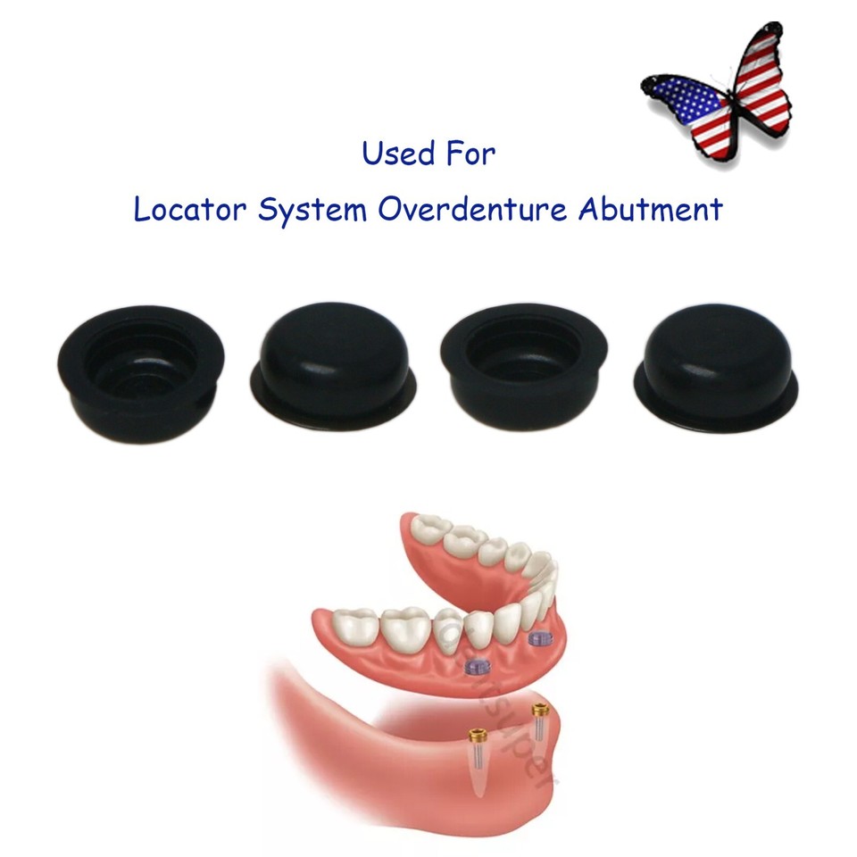 US Dental Retention Caps Lab Cap for Overdenture Locator male ...