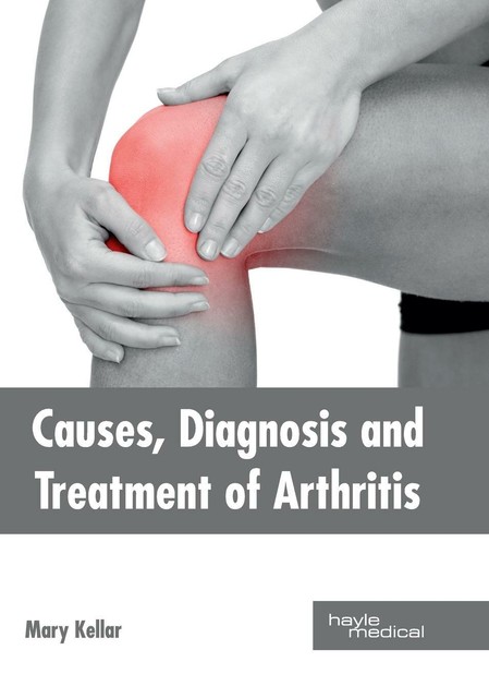 Causes, Diagnosis And Treatment of Arthritis von Mary Kellar (2017 ...