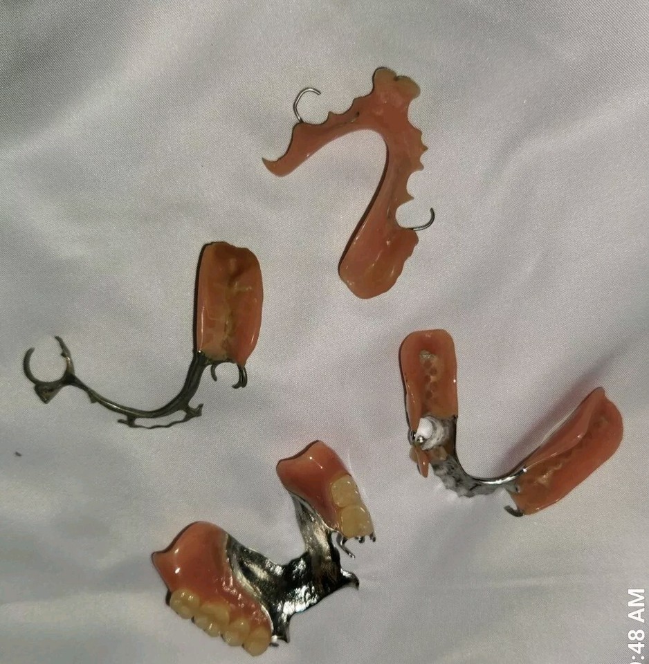 Metal Partial Dentures, Dental Teeth, Dentist White Metal Scrap ...