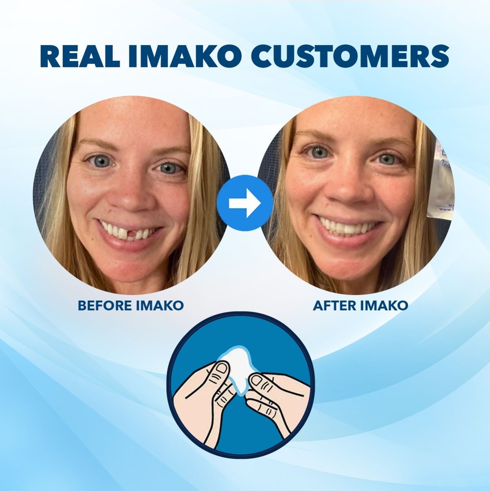 Imako® Tooth Tinted Plastic - Temporary Tooth - Fix Chipped Teeth, Gaps ...