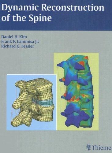 Dynamic Reconstruction of the Spine by Richard G. Fessler (2006 ...