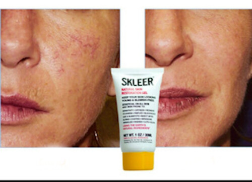 Acne, Pimples, Keratosis Pilaris or Chicken Skin Treatment - SKLEER Gel ...