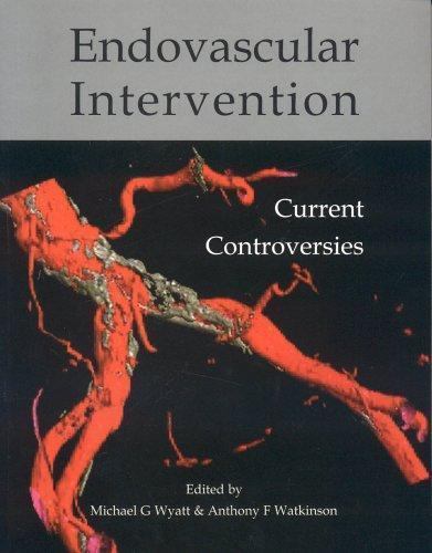 Endovascular Intervention : Current Controversies by Anthony T ...