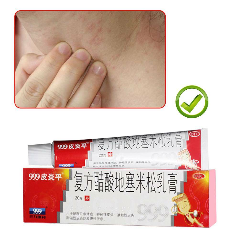 20g 999 PiYanPing Ointment Cream Anti Inflammatory for Skin Itch Relief ...