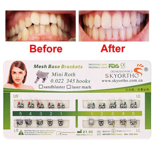 Dental Orthodontic Brackets Metal Braces Monoblock Mini Roth Slot.022 ...