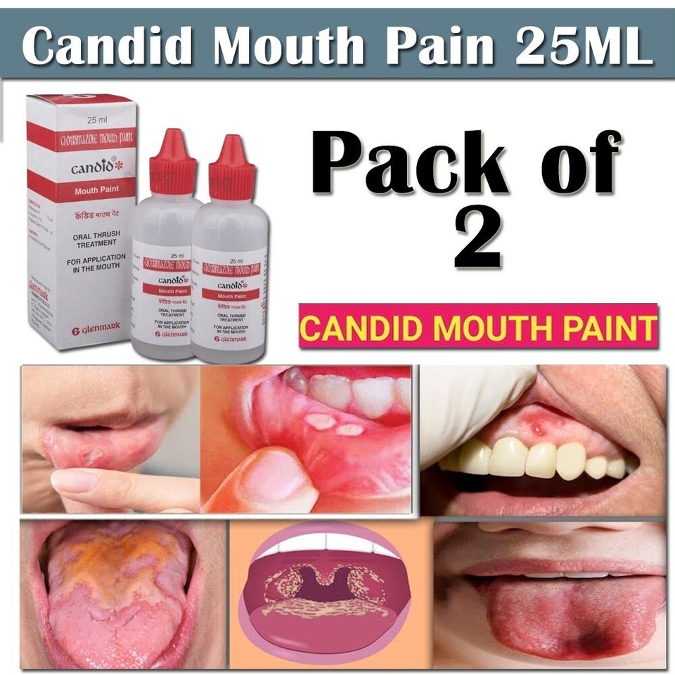 CANDID MOUTH PAINT FOR ORAL THRUSH TREATMENT FOR KILLS FUNGAL 25GM | eBay