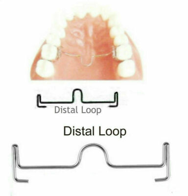 10 Pcs/Set Dental Orthodontic Palatal Arch Bar Distal Loop 37-55mm 10 ...