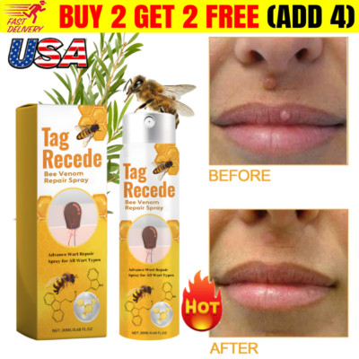 Tag Recede Bee Venom Treatment Spray,Tag Recede,Bee Venom Spray for All ...