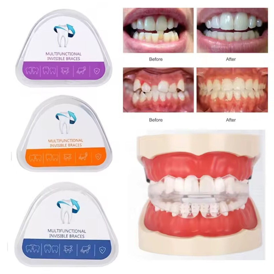 3 Stage Dental Orthodontic Teeth Corrector Braces Tooth Retainer ...