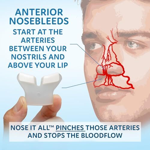 Nose It All - Nosebleed Stopper 3pk (Size Small for Users Up to 4' Tall ...