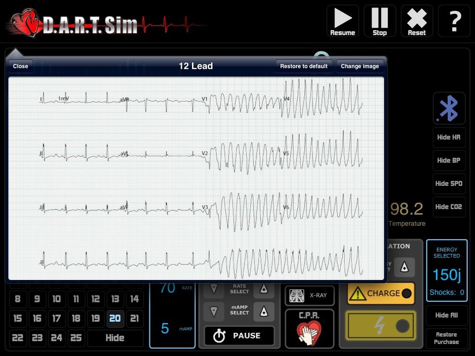 DART Sim Bag Complete ACLS & PALS ECG Simulator/ Defib Simulator Kit | eBay