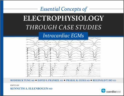 Essential Concepts of Electrophysiology Through Case Studies ...